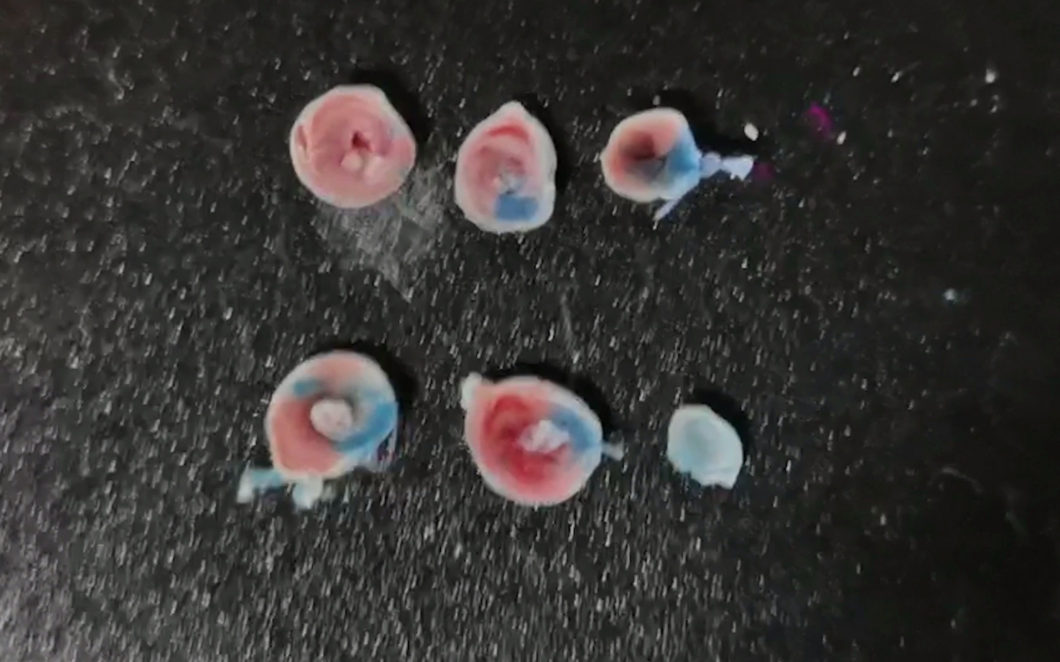 小鼠心梗TTC和Evans blue染色_哔哩哔哩_bilibili