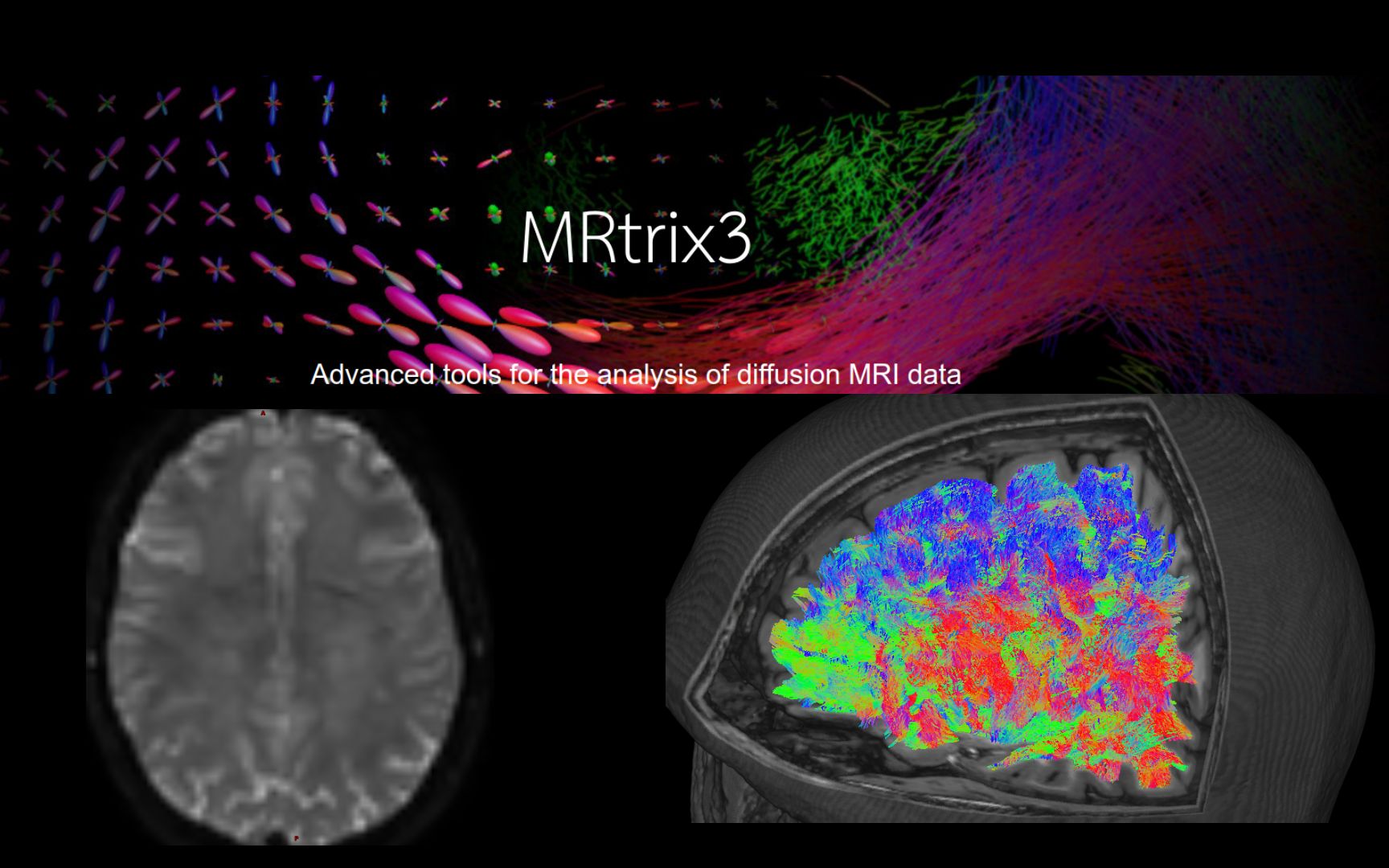 MRtrix3-弥散像分析和神经纤维束追踪-04：DWI的预处理2/2_哔哩哔哩 (゜-゜)つロ 干杯~-bilibili
