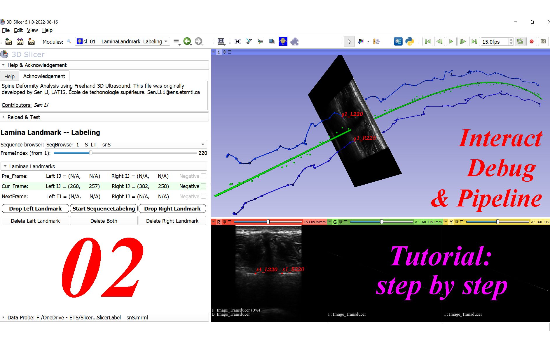 Python Interact, PyCharm Debug & 3D Slicer Pipeline -- 3D Slicer Tutorial #02-3D_Slicer-3D ...