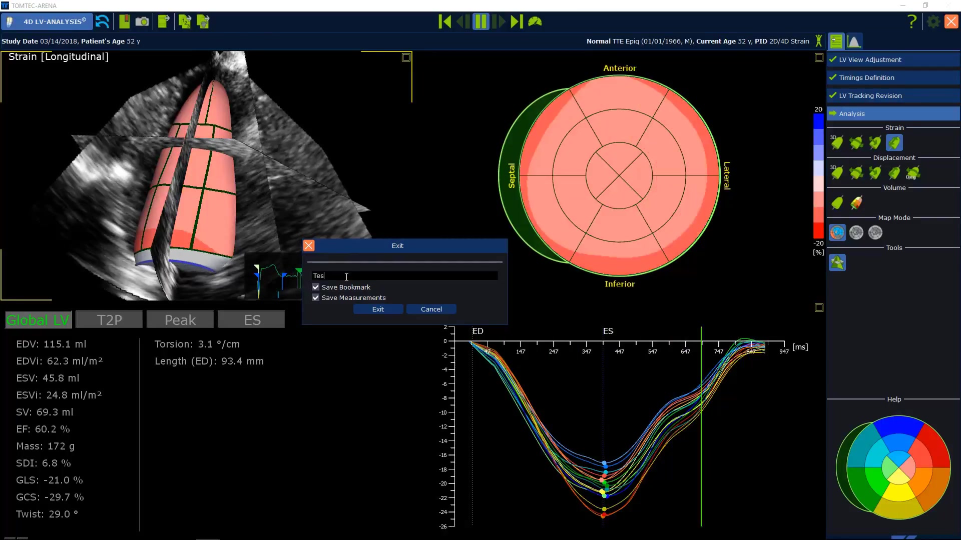 4D LV-ANALYSIS Video Tutorial TTA230_哔哩哔哩 (゜-゜)つロ 干杯~-bilibili