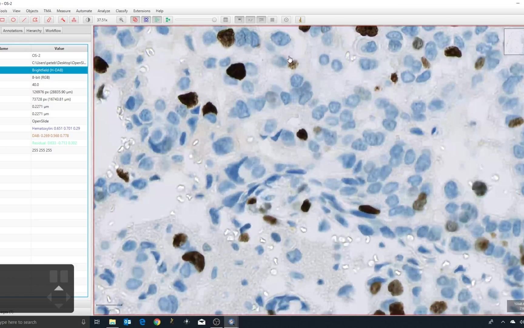 实验动物病理学切片开源处理软件QuPath官方免疫组化教程Qupath IHC_哔哩哔哩_bilibili