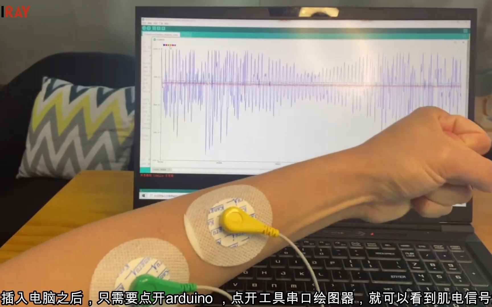 【思知瑞科技】大脑实验室 BMD101心电传感器ECG模块心率传感器套件心率HRV支持二次开发