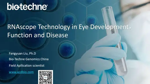ACD RNAscope在眼睛发育，功能与疾病研究中的应用_哔哩哔哩_bilibili