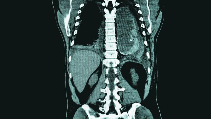 Chubbyemu的动态 - 哔哩哔哩