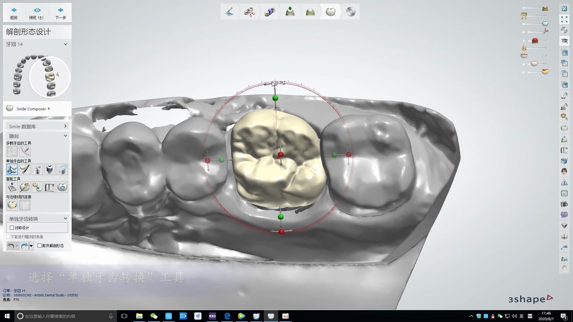 初学者的福音，3shape软件摆牙基本操作方法_哔哩哔哩 (゜-゜)つロ 干杯~-bilibili