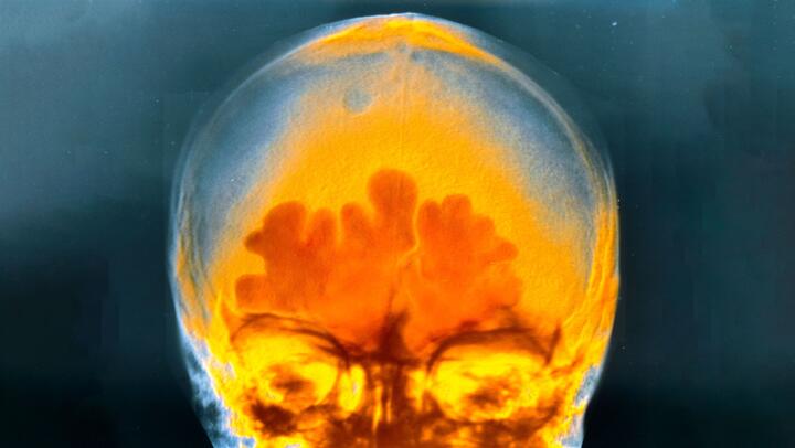 Chubbyemu的动态 - 哔哩哔哩