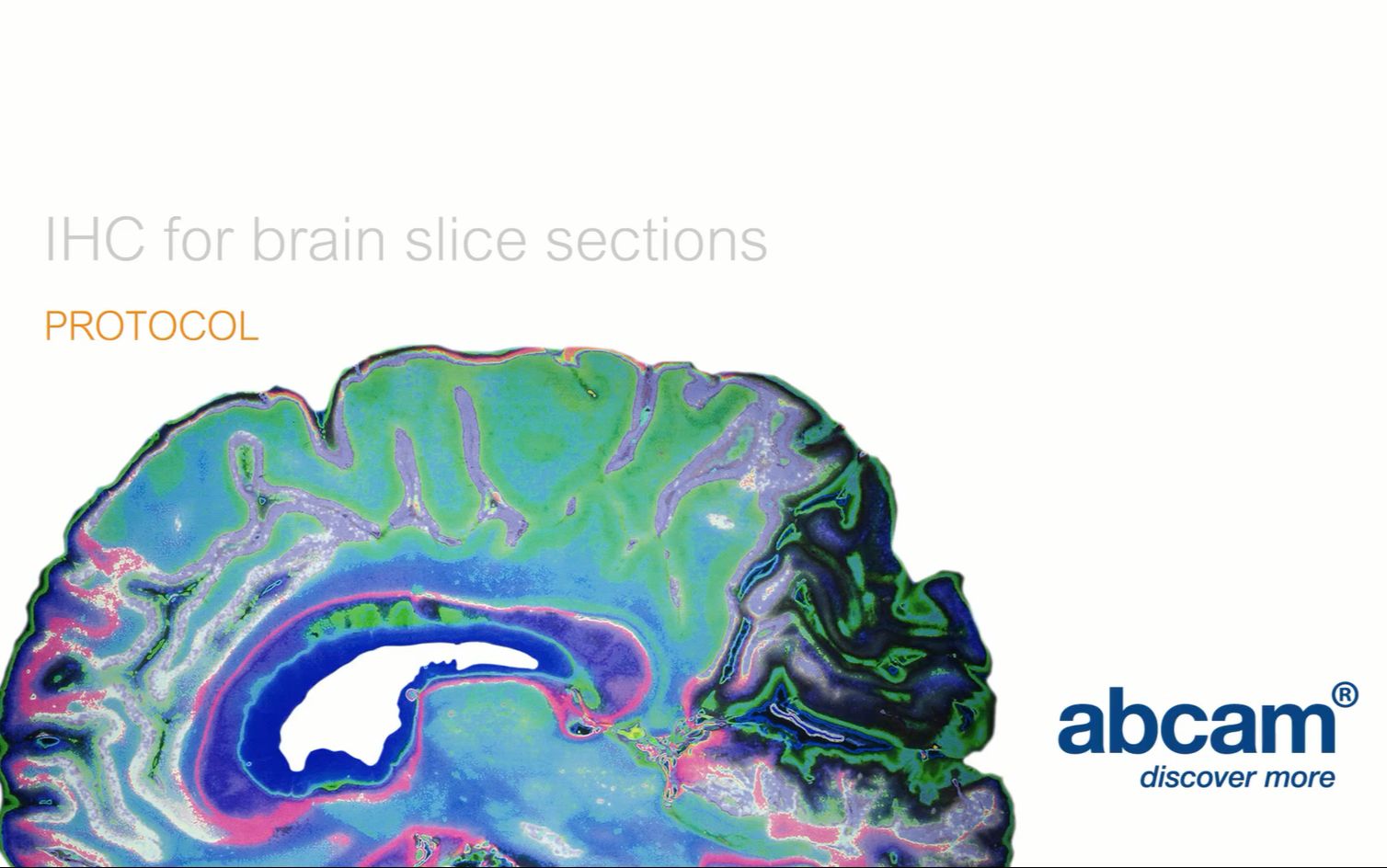 【教程】脑片的免疫组化染色（IHC for brain slice sections）_哔哩哔哩_bilibili