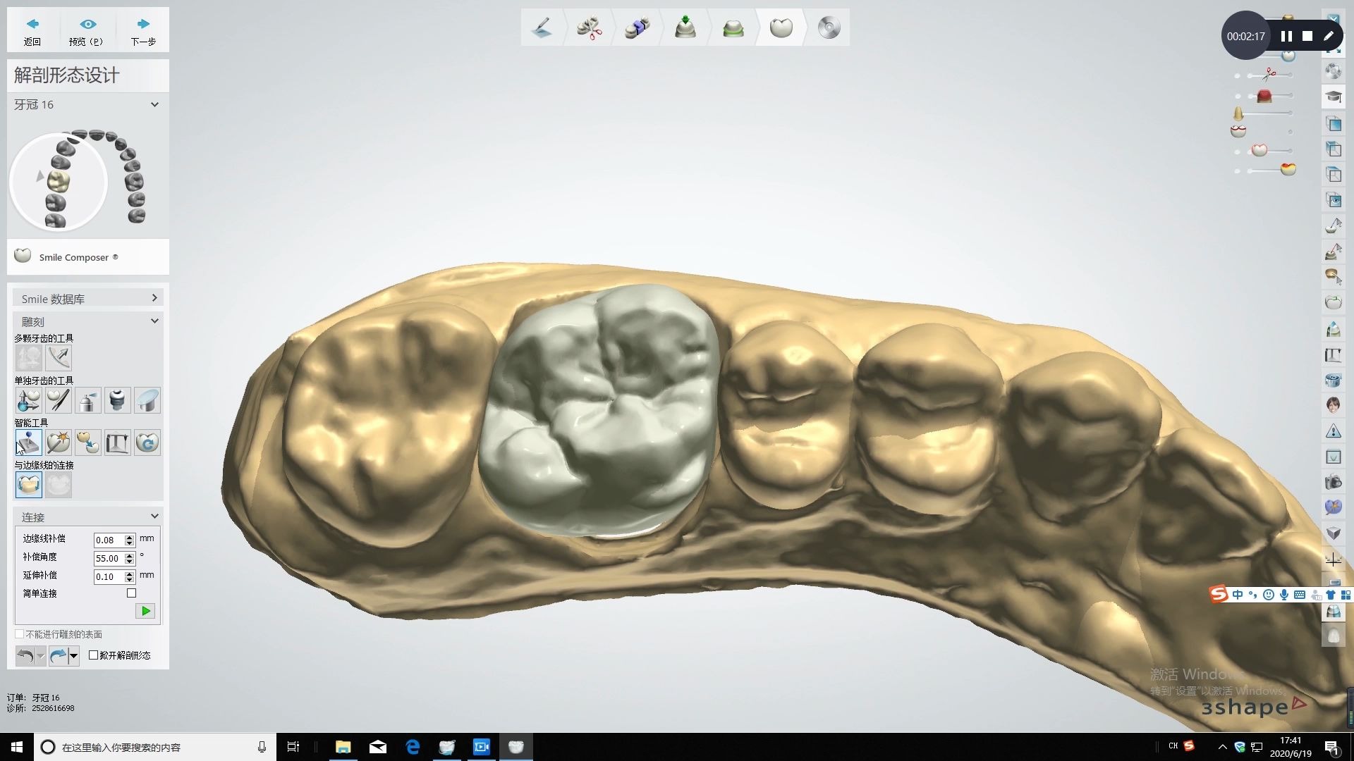 如何使用3shape设计软件，来通过视频了解工具功能及使用方法_哔哩哔哩_bilibili