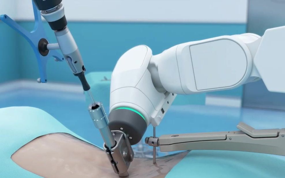 Mazor X Stealth Edition(tm) 工作原理_哔哩哔哩_bilibili