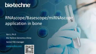 ACD RNAscope在眼睛发育，功能与疾病研究中的应用_哔哩哔哩_bilibili