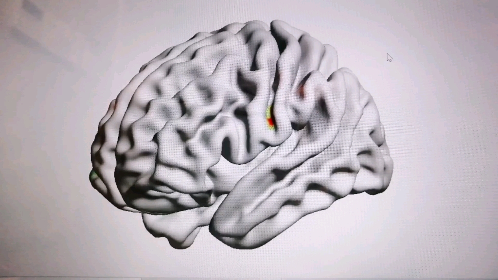 复盘BrainNet Viewer~转起来真好看_哔哩哔哩_bilibili