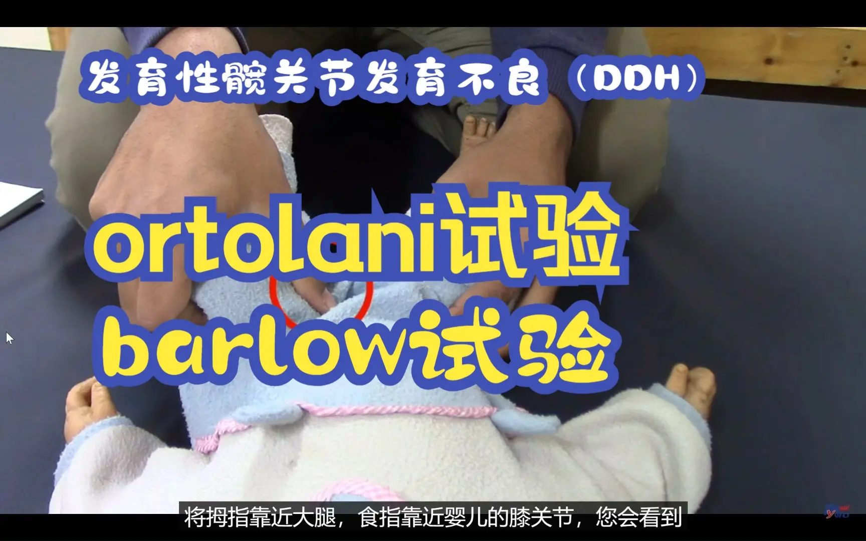 发育性髋关节发育不良（DDH）-ortolani试验和barlow试验_哔哩哔哩_bilibili