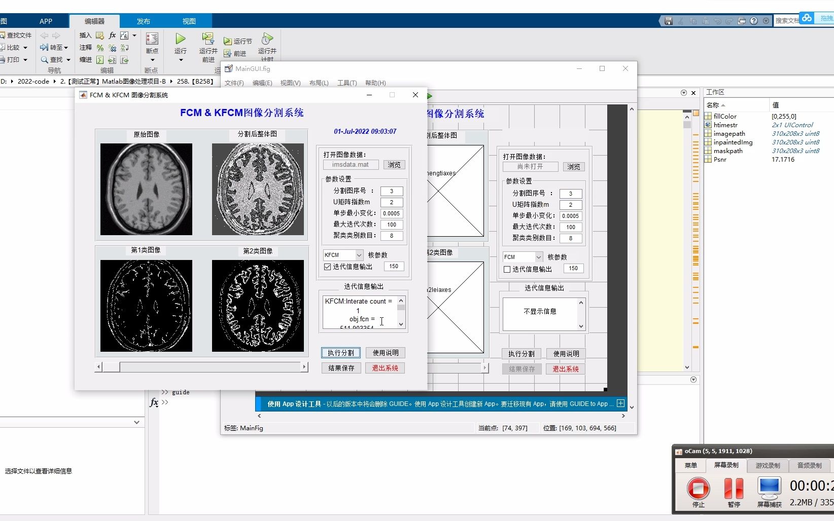 基于Matlab FCM+KFCM模糊C均值聚类分析算法图像分割系统 - 视频下载 Video Downloader
