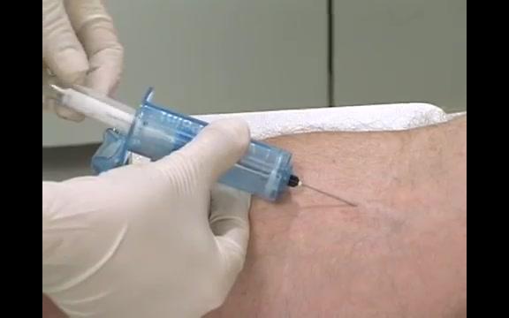 【科普】【醫療】VanishPoint® Blood Collection Tube Holder (英語無字)_哔哩哔哩 (゜-゜)つロ 干 ...