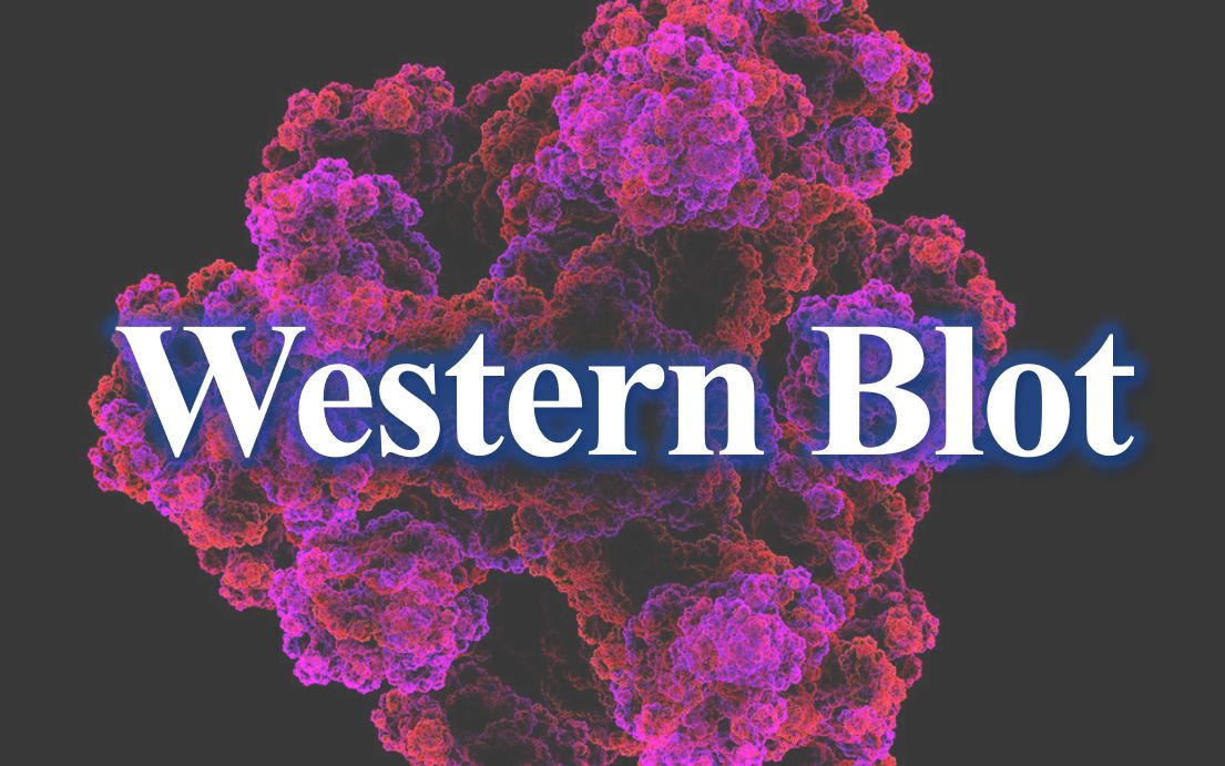【WB】蛋白质Western Blot实验原理，大家来检查一下学姐讲的对不对_哔哩哔哩_bilibili
