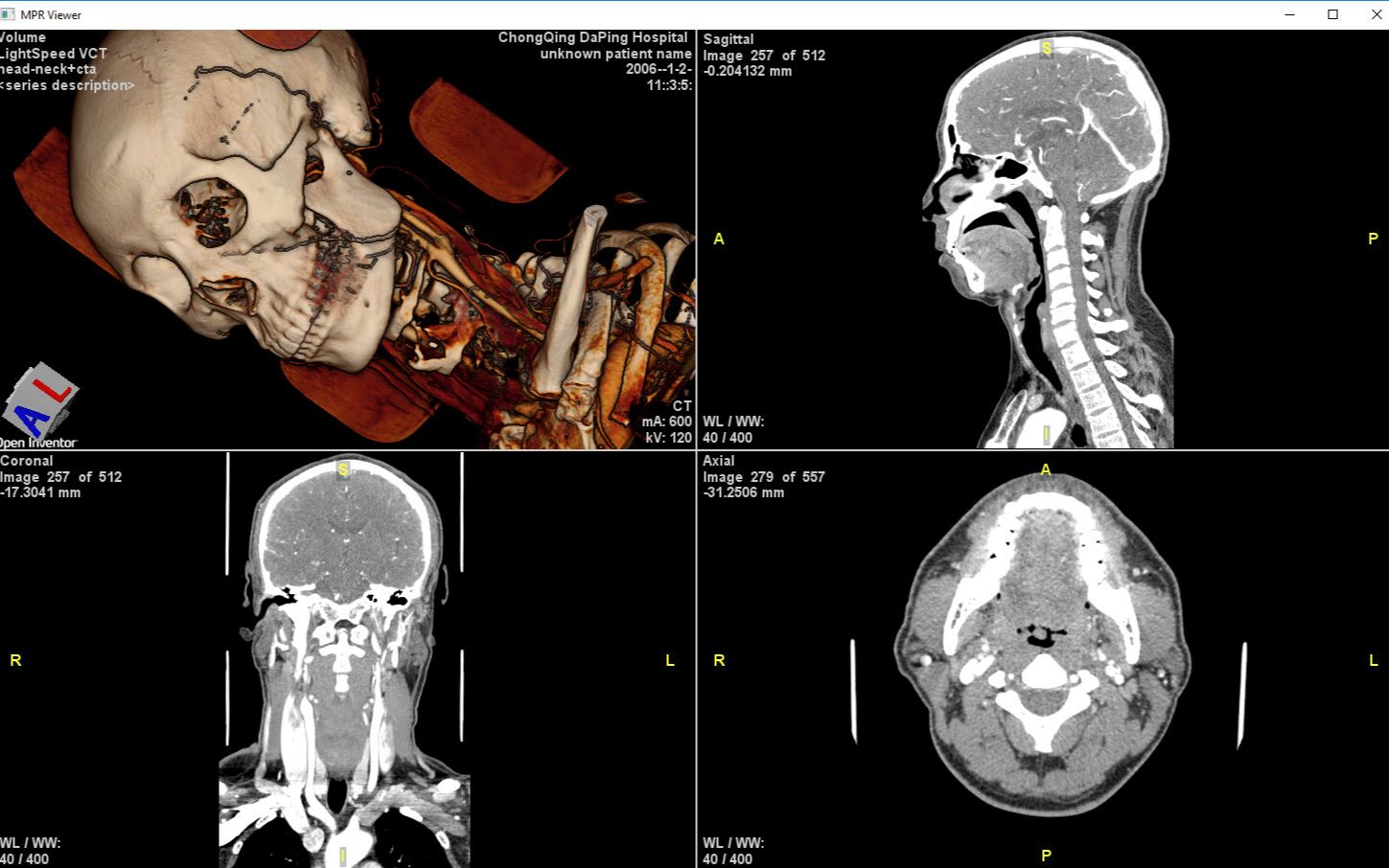 Open Inventor 三维开发包 - 用于开发CT或电镜可视化软件_哔哩哔哩_bilibili