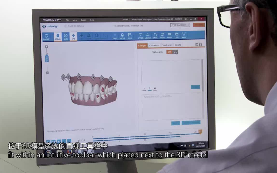 带3D 控制功能的ClinCheck Pro介绍_哔哩哔哩_bilibili