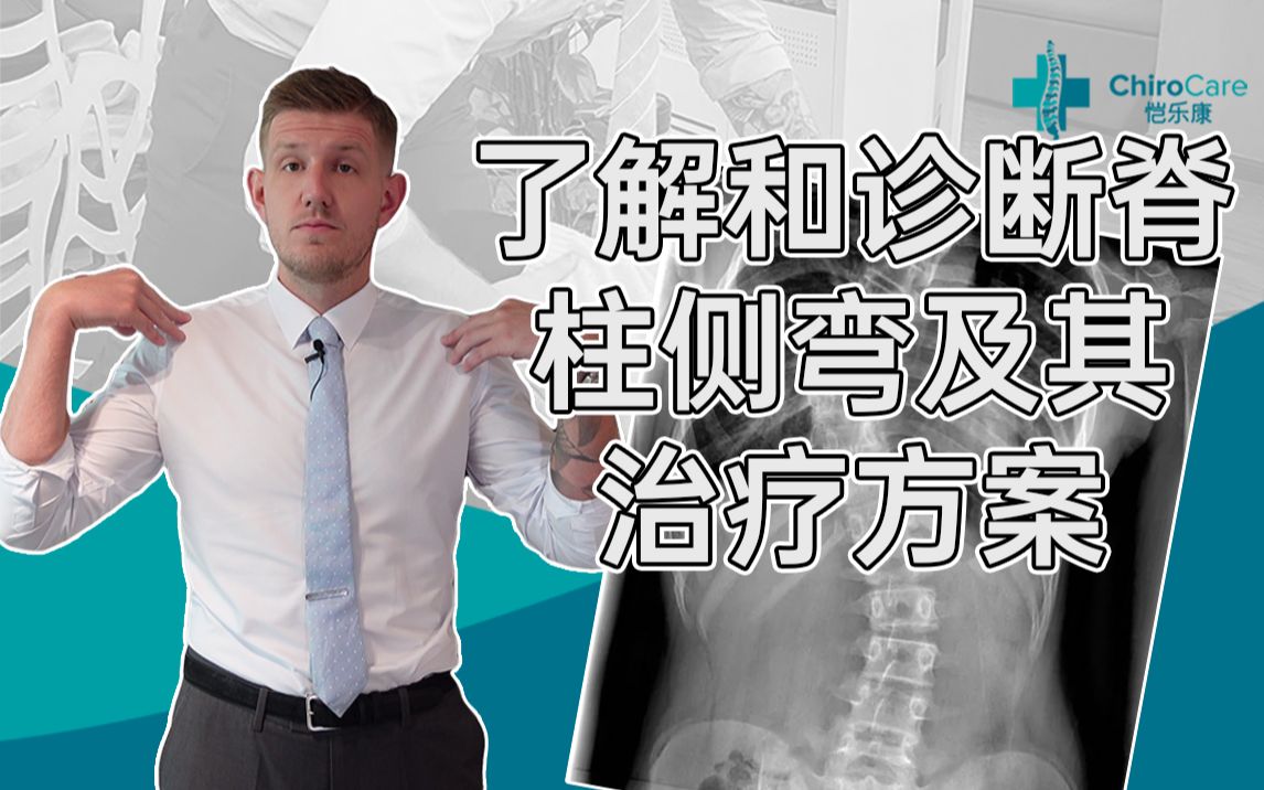 美式整脊能否治愈脊柱侧弯？-美式整脊DrAlex-美式整脊DrAlex-哔哩哔哩视频